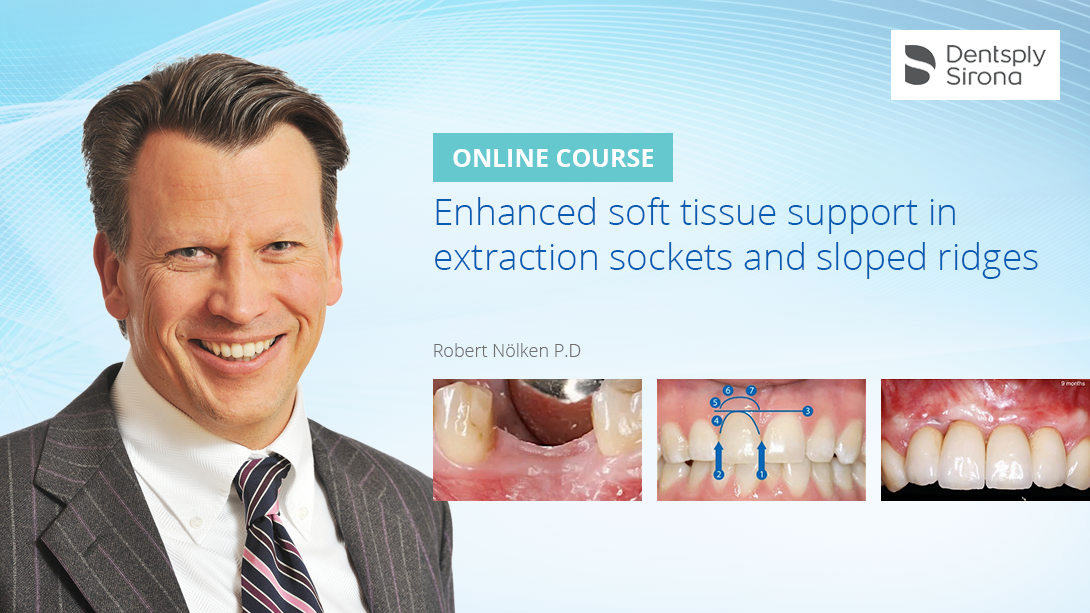 DT Study Club Webinar: Enhanced soft tissue support in extraction ...